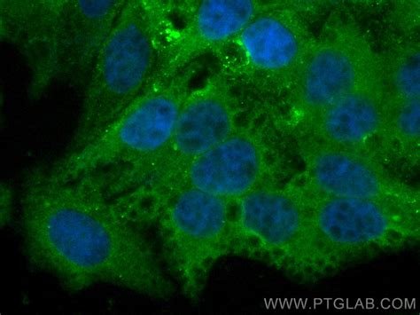 Sec61b Antibody Cl488 15087 Proteintech