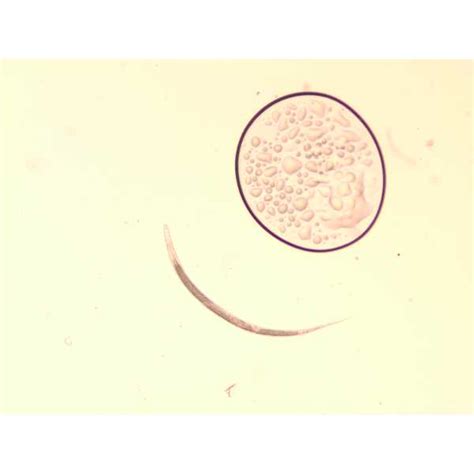 Tylenchus Applied Nematology Ecology And Acoustical Signatures