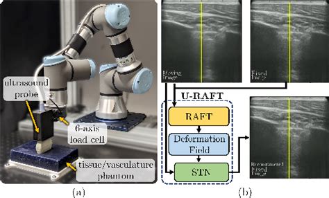 Unsupervised Deformable Image Registration For Respiratory Motion Compensation In Ultrasound
