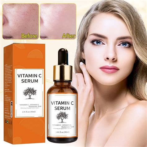 Xaoyunyn Nourishing 1 Fl Oz Vitamin C Serum For Skin Brightening