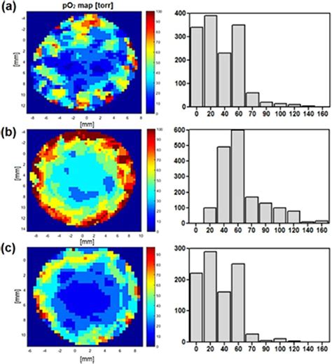 Representative Oxygen Maps Of The Area Of Interest Tumor Is In The