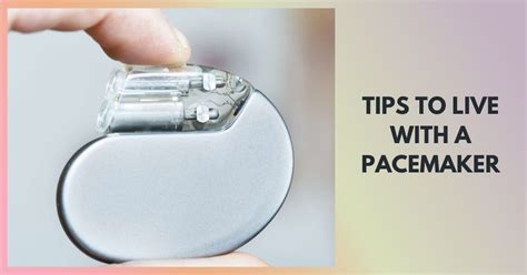 Will A Pacemaker Keep You From Dying At Walter Mcglothlin Blog