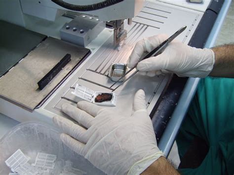 Formalin Fixed Paraffin Embedded Tissue Processing