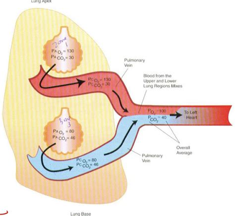 Ventilation Perfusion Relationships Flashcards Quizlet
