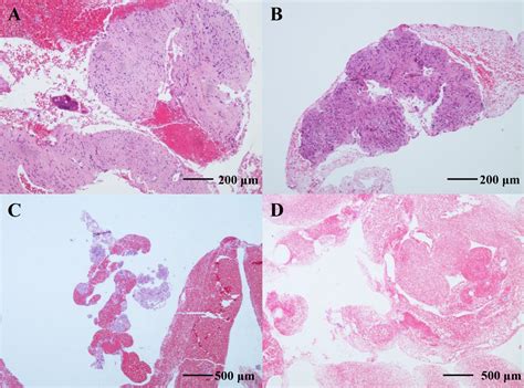 Endoscopic Ultrasound