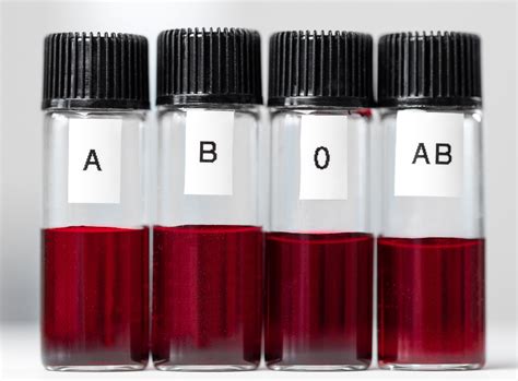 The Importance Of Blood Typing Path 24 Laboratories