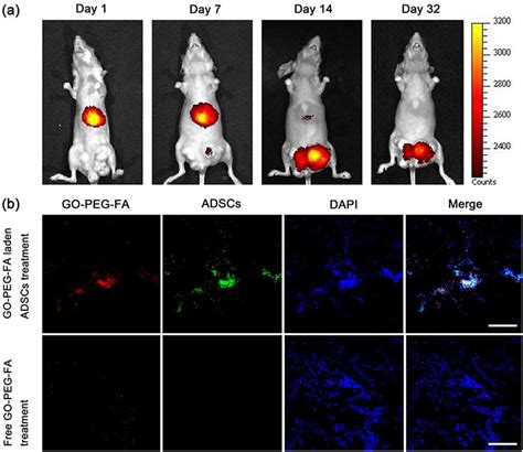 Hydrophilic Graphene Oxide Nanocomposites Breast Cancer Ijn
