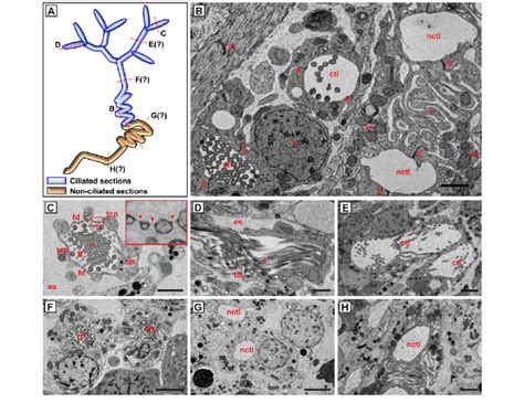Ultrastructure Of Cell Types In The Planarian Protonephridial System Download Scientific