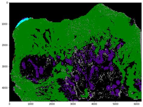 Color Thresholding Semantic Segmentation Histomicstk Documentation