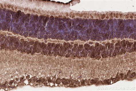 Ihceasy Rd3 Ready To Use Ihc Kit Khc2619 Proteintech