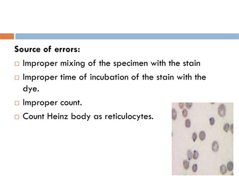 60658reticulocytes Countpdf