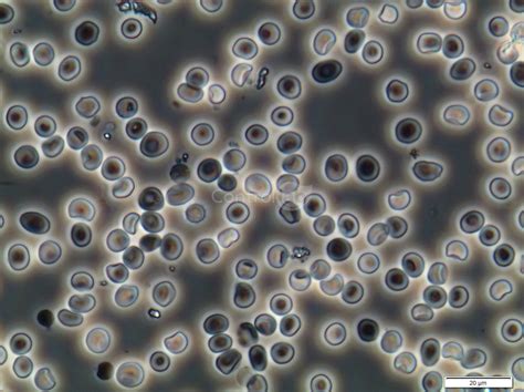 Sedimento Urinário Controllab