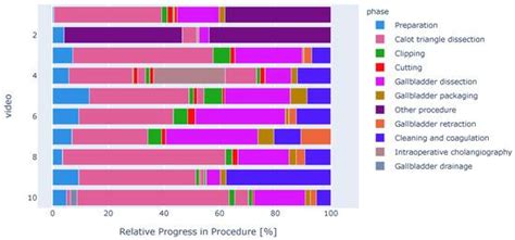 Surgical Phase Recognition From Public Datasets To Real World Data Florian Aspart