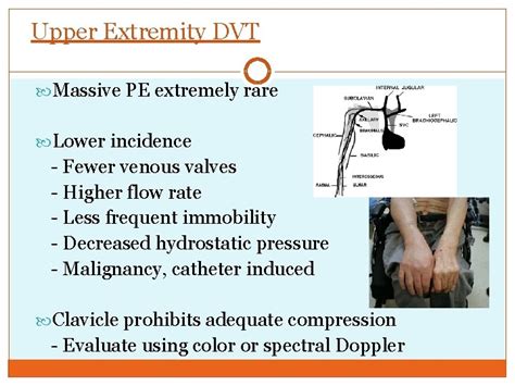 Deep Venous Thrombosis Turandot Saul M D September