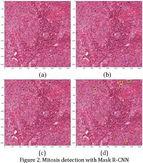 Figure 1 From A Hybridized Deep Learning Methodology For Mitosis