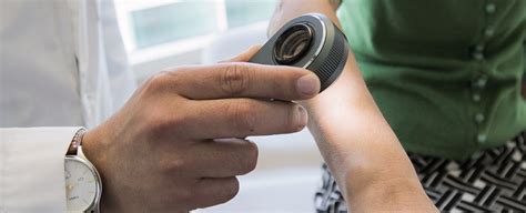 Ai Can Now Accurately Identify Skin Cancer And Is Coming To Your