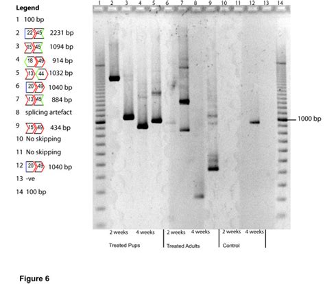 Amplification Of Dystrophin Exons 1350 Rna Extracted From Treated And