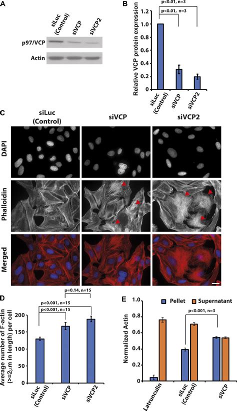 Figure 1 From A Novel Function Of Aaa Atpase P97 Vcp In The Regulation Of Cell Motility