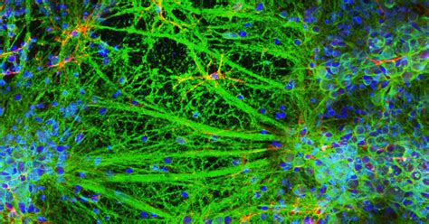 A Lab Just 3d Printed A Neural Network Of Living Brain Cells Ztoog