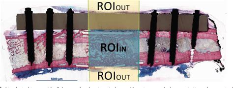 Figure 2 From Regenerating Critical Size Rat Segmental Bone Defects