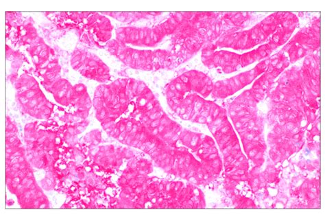 Signalstain® Boost Ihc Detection Reagent Ap Rat Cell Signaling