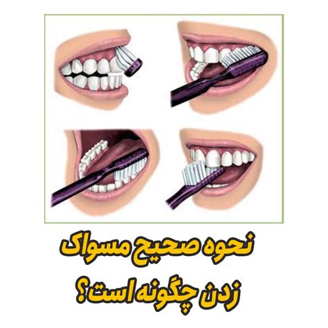 نحوه صحیح مسواک زدن چگونه است؟ فروشگاه اینترنتی لبخند زیبا