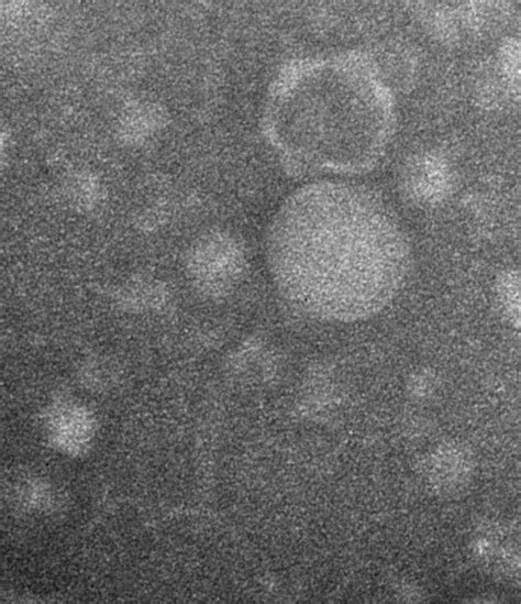 The Actinobacteriophage Database Phage Atlantica