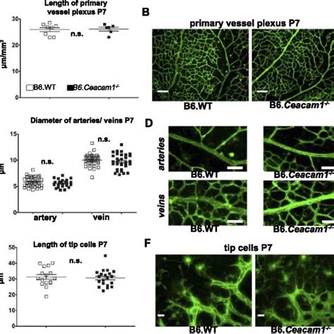 Comparison Of The Primary Plexus Vascular Tree And Tip Cells In