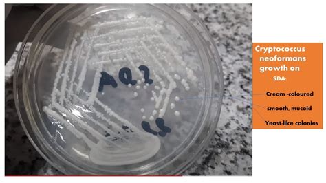 Cryptococcus Colony