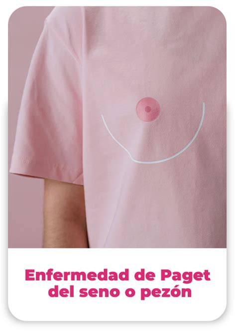 Factores De Riesgo Festival De La Mujer