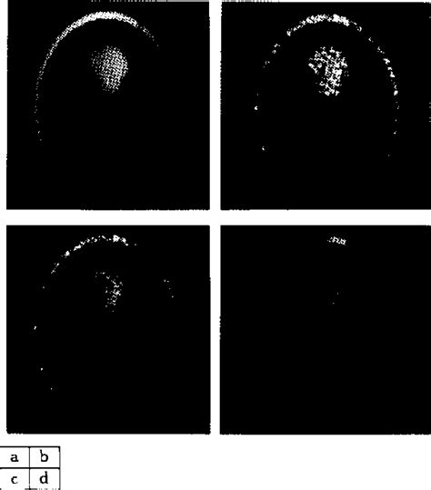 Figure 4 From Edge Preserving Map Image Reconstruction From Projections