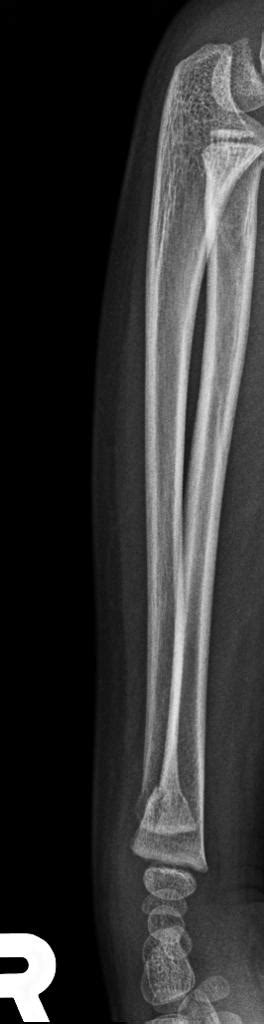 Image Radiopaedia Org