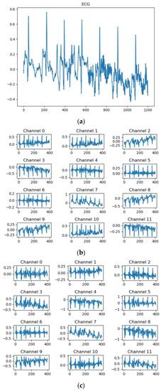 A Domain Based Adaptive Multi Scale Inter Subject Sleep Stage Classification Network