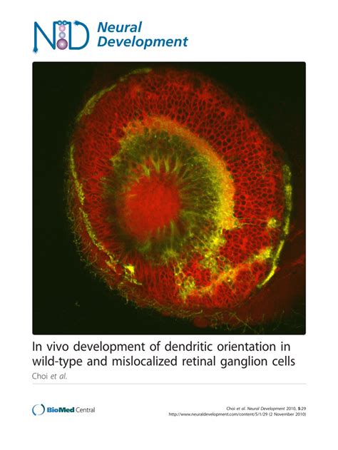 Pdf In Vivo Development Of Dendritic Orientation In Wild Type And