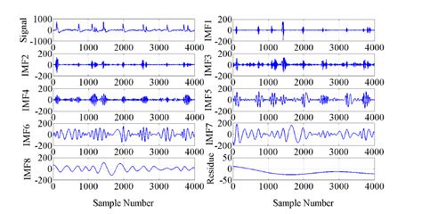 Empirical Mode Decomposition Of The 236 Second Seizure Free Eeg Signal