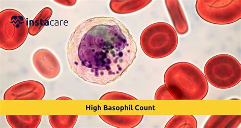 Basophilia Meaning Basophilia And Basophiliosis In Caged Hens At 18