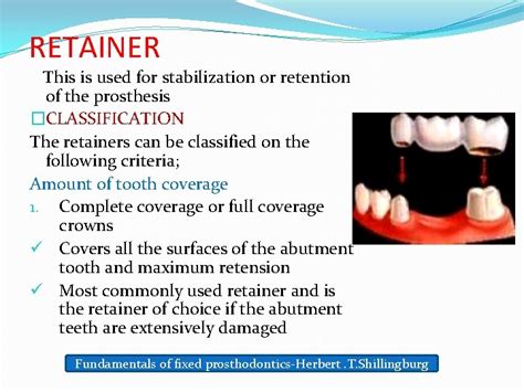 General Considerations Components And Classification Of Fpd Christeena