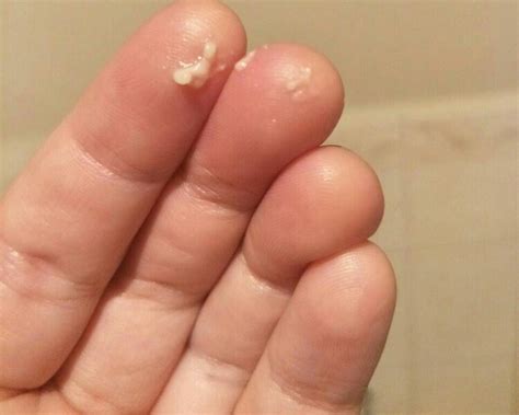 The Ultimate Guide To Cervical Mucus With Photos — Fertility Awareness