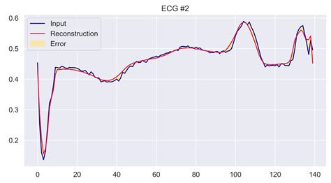 github jeffbeech detecting abnormal ecgs using neural network