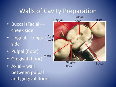 Ppt Dental Terminology Powerpoint Presentation Free Download Id