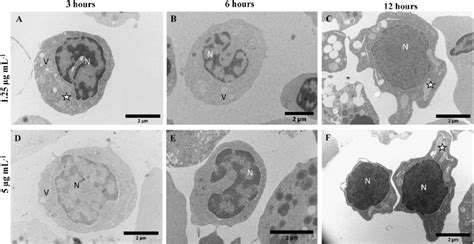 Transmission Electron Micrographs Of Monocytes Macrophages From