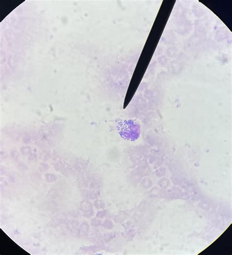 Help How Do I Get Wright Stain Off My Uniform I Was Wearing My Lab