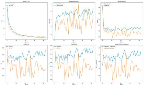 Efficientunetvit Efficient Breast Tumor Segmentation Utilizing Unet Architecture And Pretrained