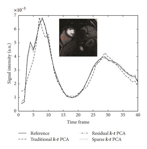 Of The Quantitative Performance Of Three K T Pca Methods On 4 Fold