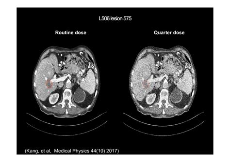 Deep Learning For Ct Reconstruction From Concept To Practices Speaker Deck