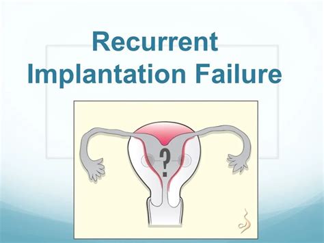 Implantation Failure Ivf Recurrent Implantation Failure Definition