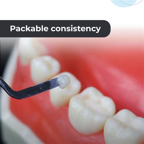 Shop Waldent Nanofill Zirconium Composite Kit Premium Dental Composite Kit Online Dentalkart