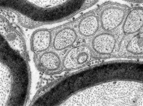 Nerve Fibres Tem Stock Image C036 1050 Science Photo Library