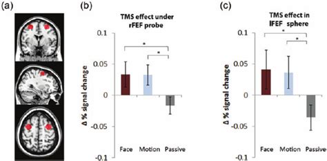 TMS Effects On BOLD Signal In The Stimulated Right FEF And The Left FEF Download Scientific
