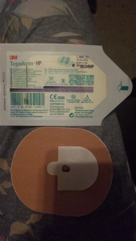 Dexcom Rash R Diabetes T1